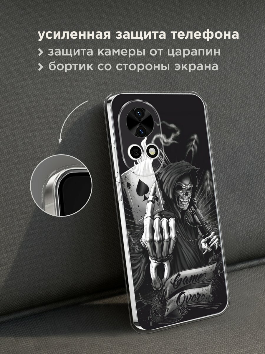Чехол на Huawei Nova 12/Nova13 / Хуавей Нова 12/Нова 13 с принтом "Игра закончена" — фото 1