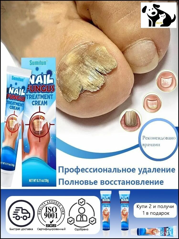 Эксклюзивный крем для ногтевой пластины, 30 грамм, противомикозный