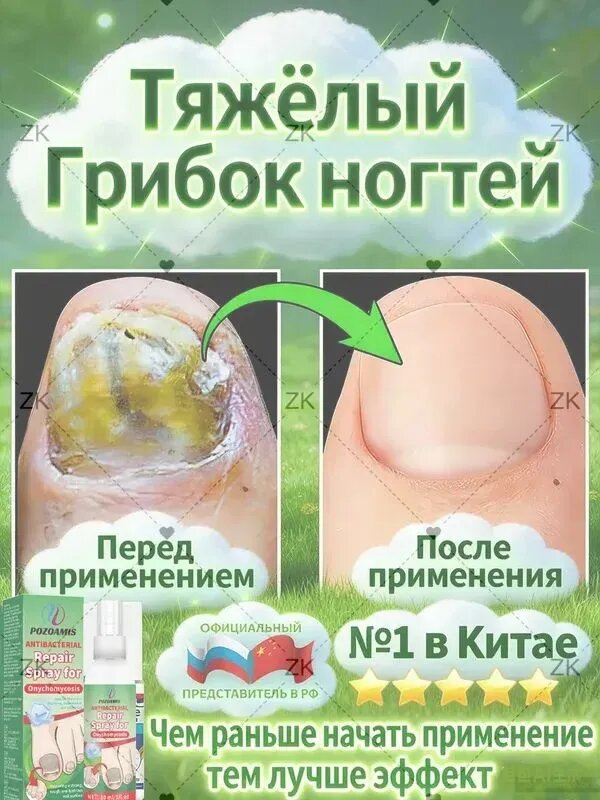 Эффективный спрей от грибка ногтей с натуральным маслом