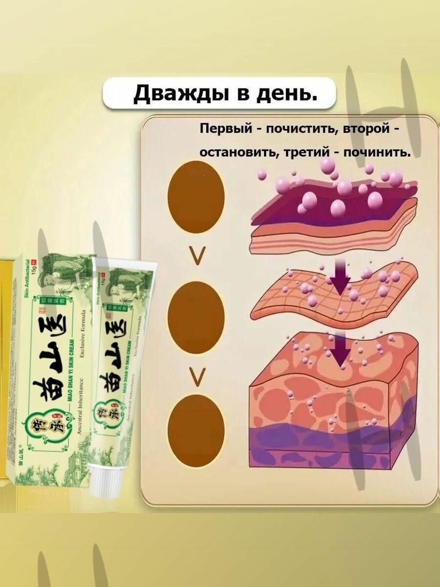 MiaoShanYi мазь 5шт. (MXY) от псориаза, экземы, дерматита, зуда, потницы, грибка, лишая (Семейный врач Мяо), мазь от псориаза и дерматита