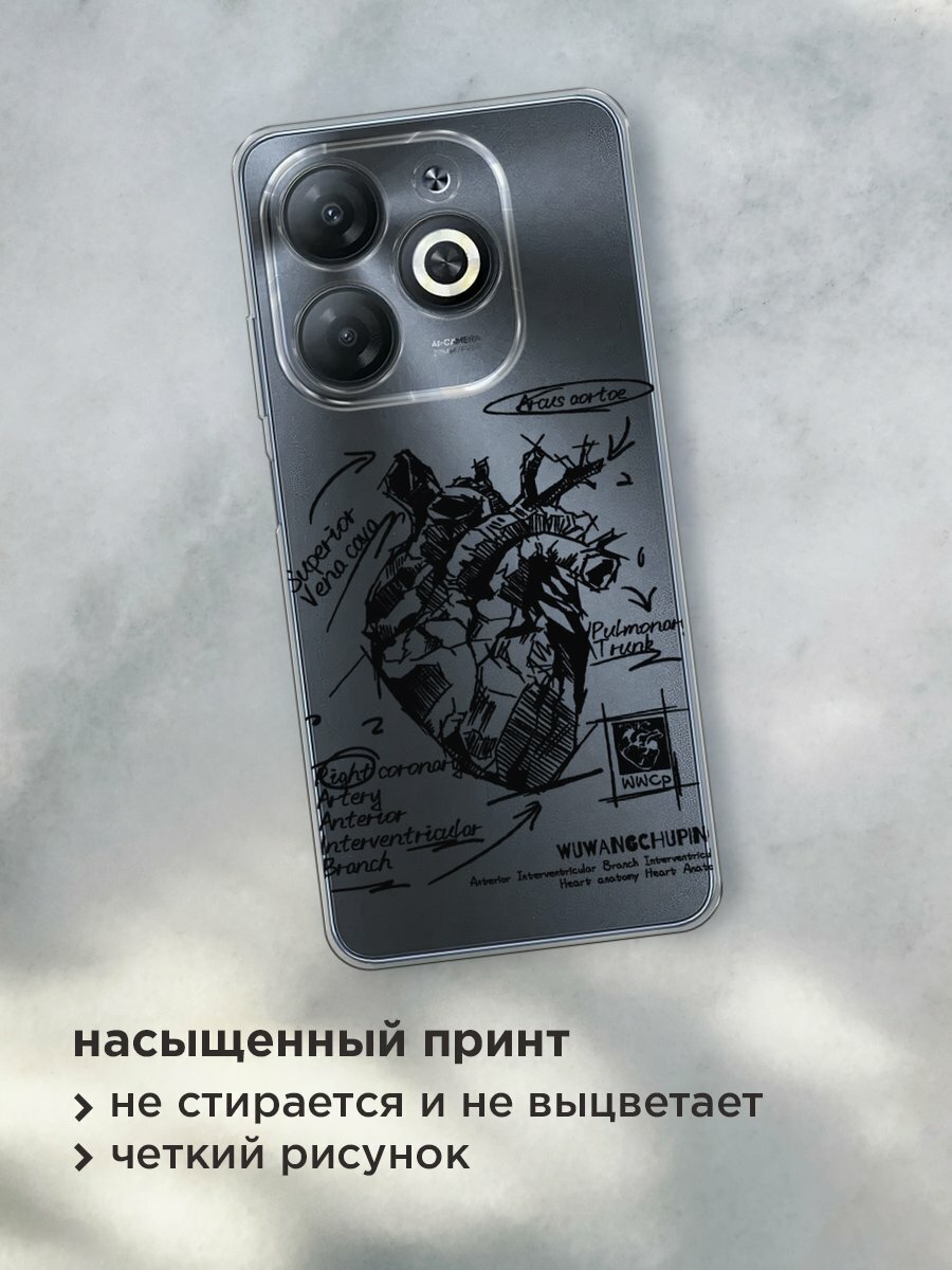Чехол на Infinix Smart 8/8 HD/HOT 40i / Инфиникс Смарт 8/8 HD/HOT 40i с принтом "Анатомическое сердце 2", прозрачный — фото 1