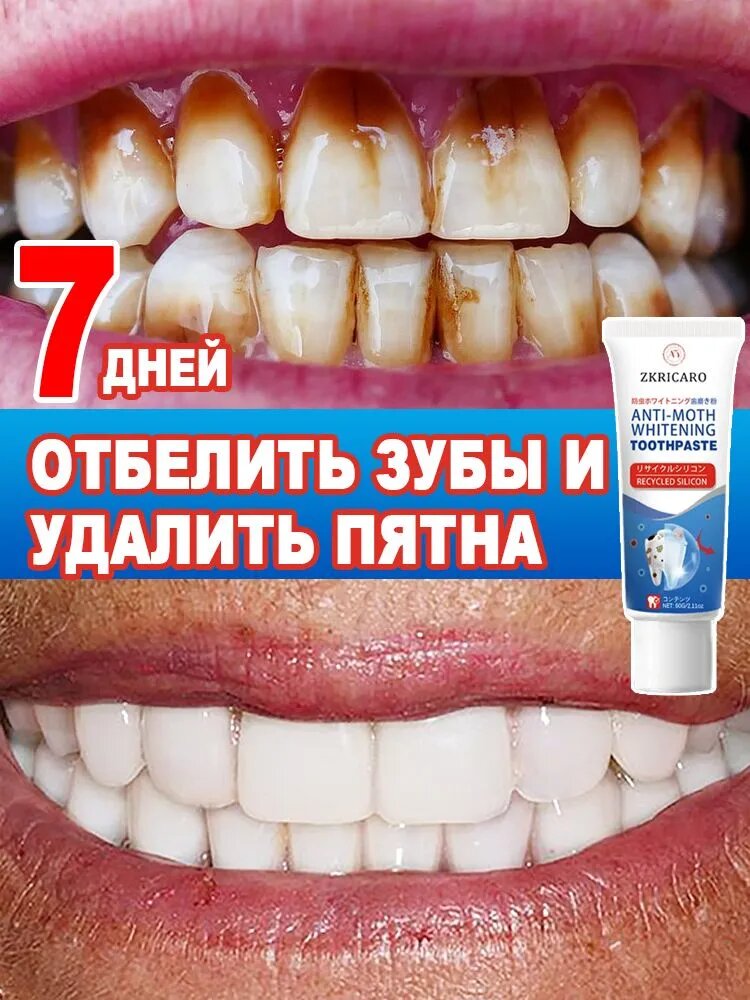 Отбеливающая и противокариесная зубная паста, эффективно отбеливает зубы, лечит кариес, удаляет зубной камень, налет, неприятный запах изо рта, укрепляет зубную эмаль и десны, 60 г