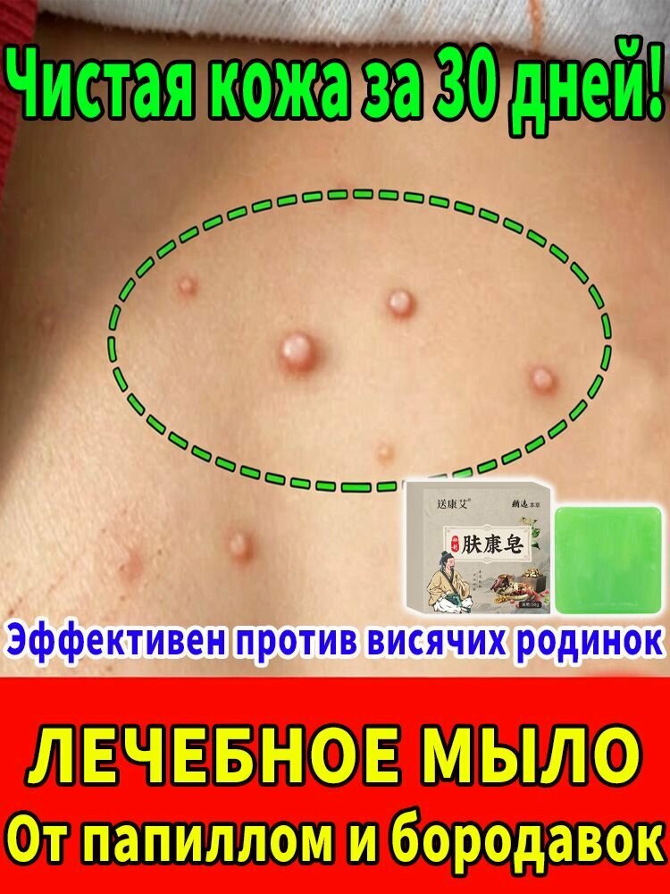 Крем для удаления бородавок. Подходит для всех типов кожи, удаляет различные бородавки, папилломы и сухие мозоли. Безболезненно, без рубцов и побочных эффектов.