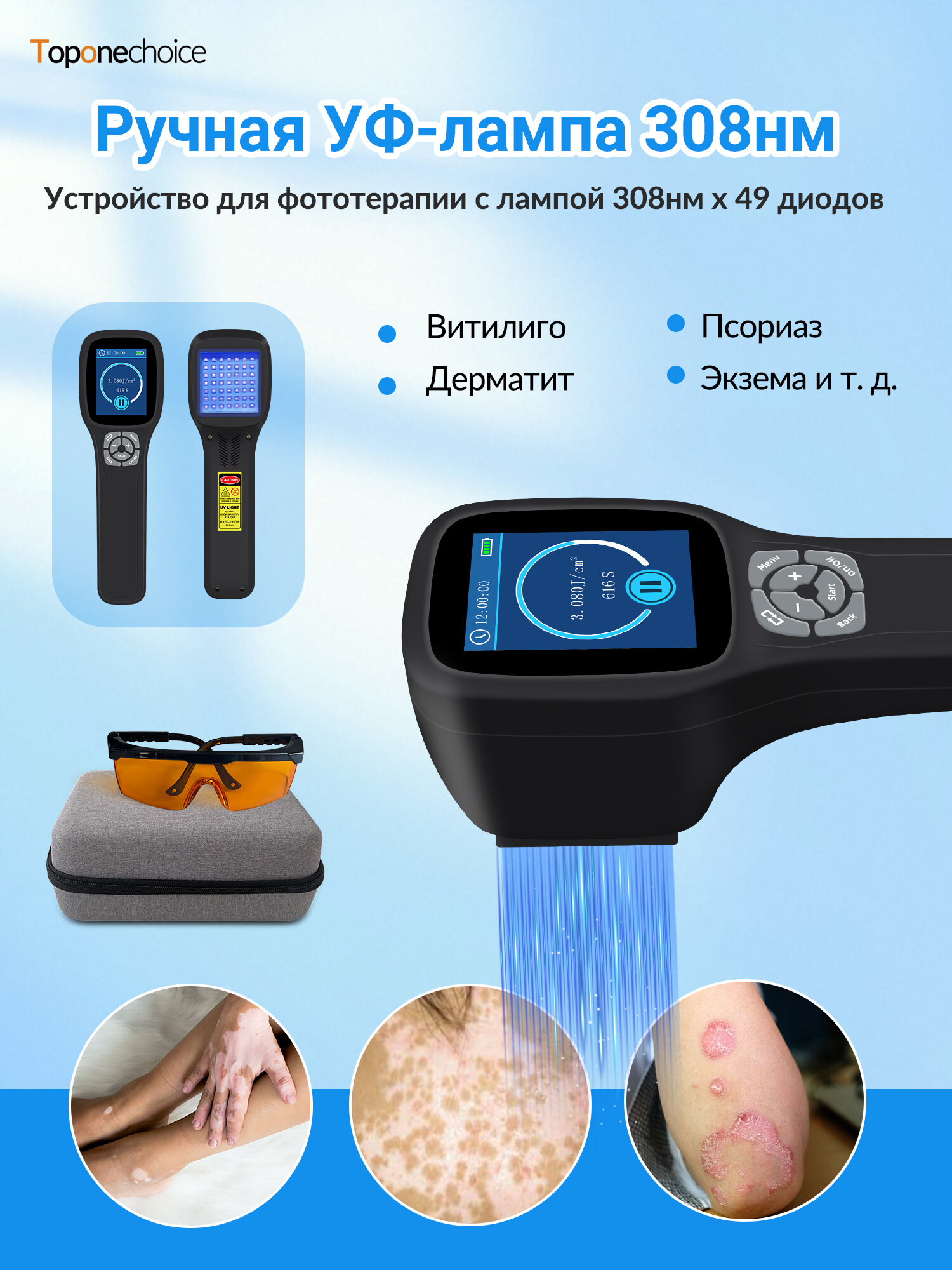 УФБ 308 нм фототерапия аппарат 5 40 мВт см² для всех участков кожи