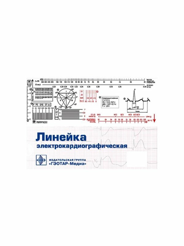 Линейка электрокардиографическая: ЭКГ-линейка для расшифровки электрокардиограммы, снят.