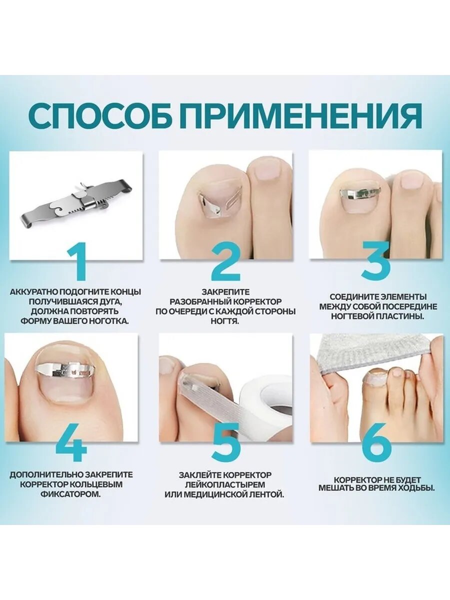 Корректор для вросшего ногтя L — безопасное решение