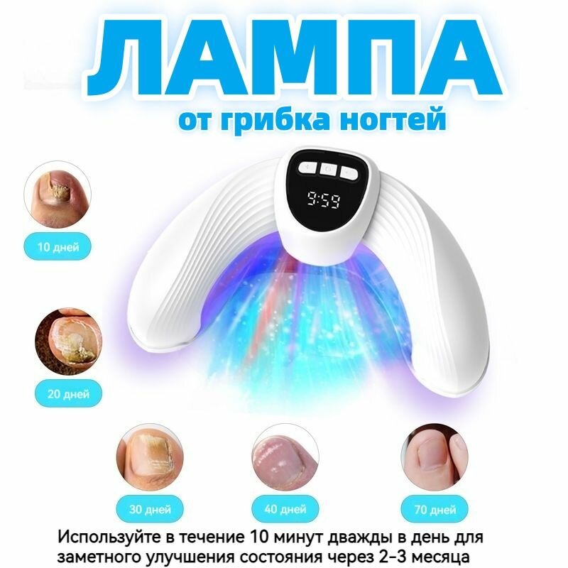 Лампа для лечения грибка ногтей на ногах и руках; профессиональная фототерапевтическая система для маникюра и педикюра фототерапия грибка ногтей профессиональная лампа для маникюра