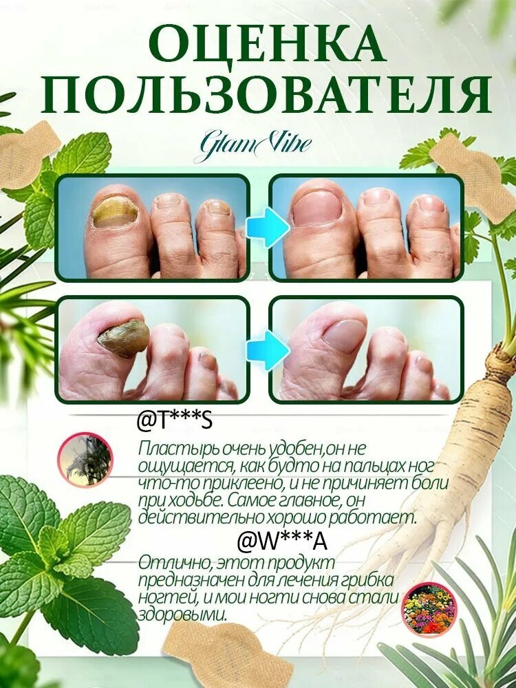 Пластыри от онихомикоза устраняют грибковые инфекции, улучшают состояние утолщенных и пожелтевших ногтей и обеспечивают быстрый результат. В наличии 63 пластырь.