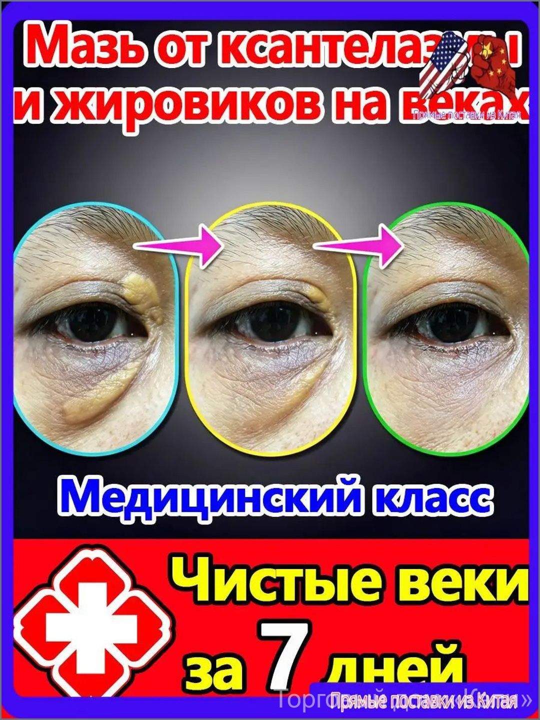 Средство от ксантелазмы без операции: уход за кожей век
