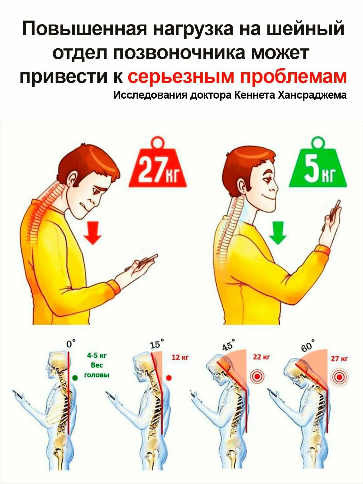 Тренажер для шеи — фото 1