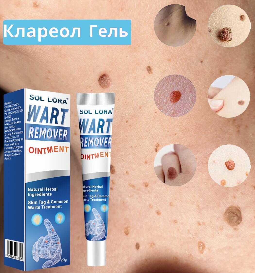 Мазь для выведения бородавок, 20 г, бережное удаление папиллом и вирусных наростов