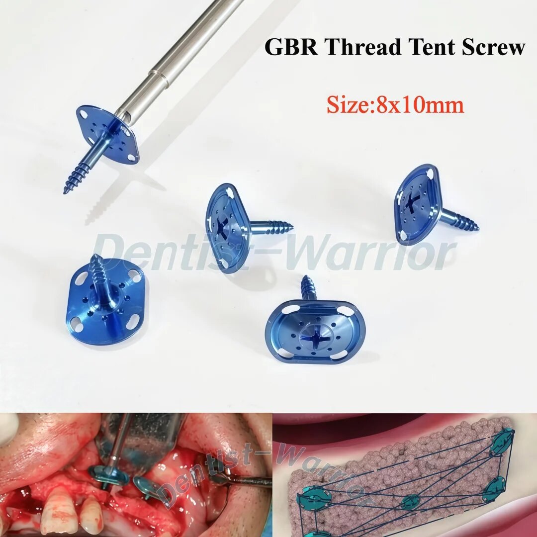 ACMEDENT Стоматологический винт GBR синий, Screws-5Pcs, 8x10 мм