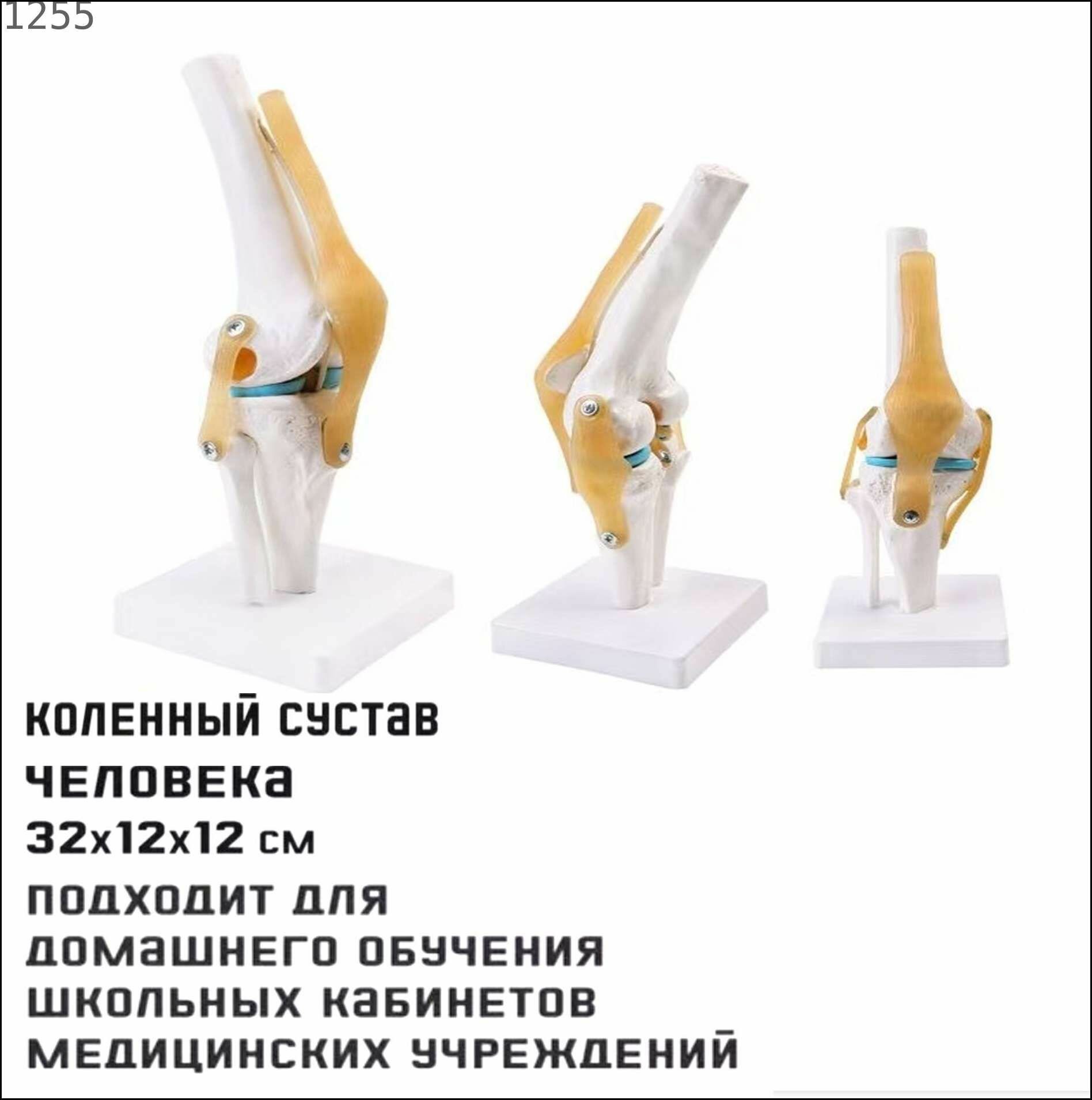 Схема расположения колена