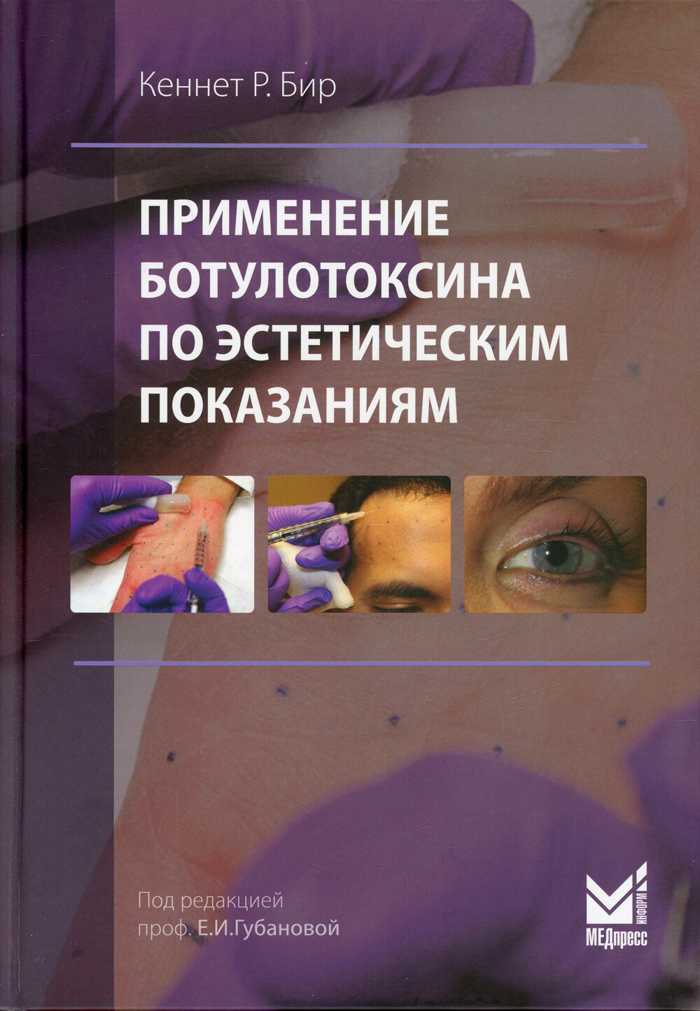 Применение ботулотоксина по эстетическим показаниям. Теория и практика. Бир К. Р.