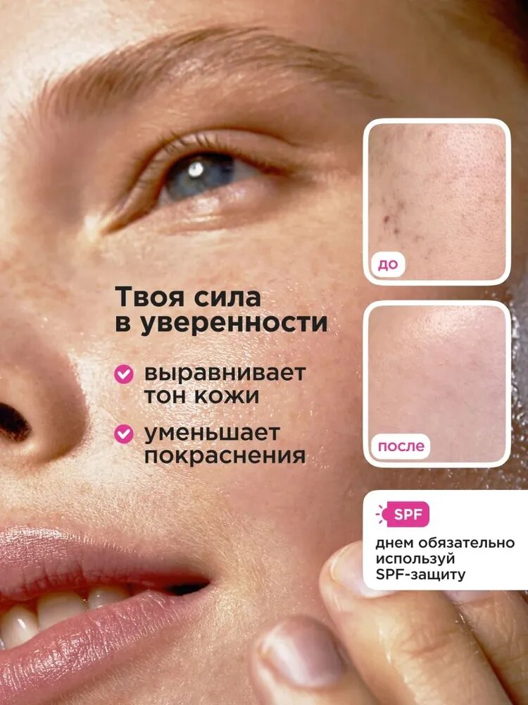 VOIS Сыворотка для лица c азелаиновой кислотой 10%