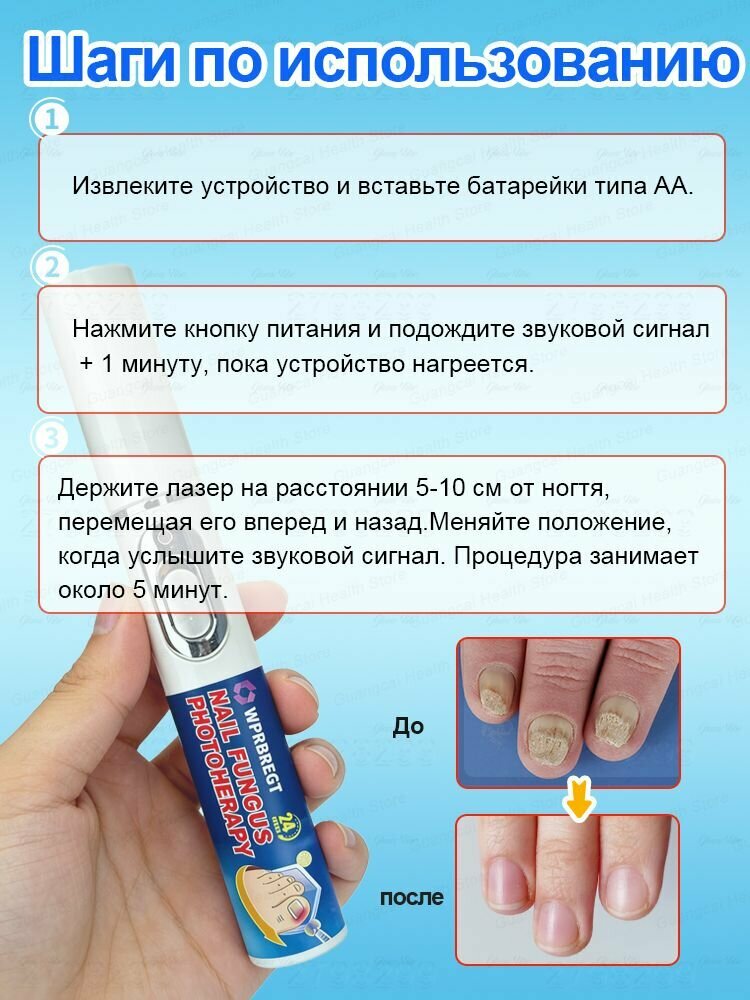 Лазерная ручка для лечения онихомикоза, 1 шт. Она устраняет пожелтение, утолщение и ломкость ногтей, восстанавливает поврежденные ногти, безболезненна, щадяща и не вызывает раздражения лазер для ногтей антигрибковое средство восстановление н