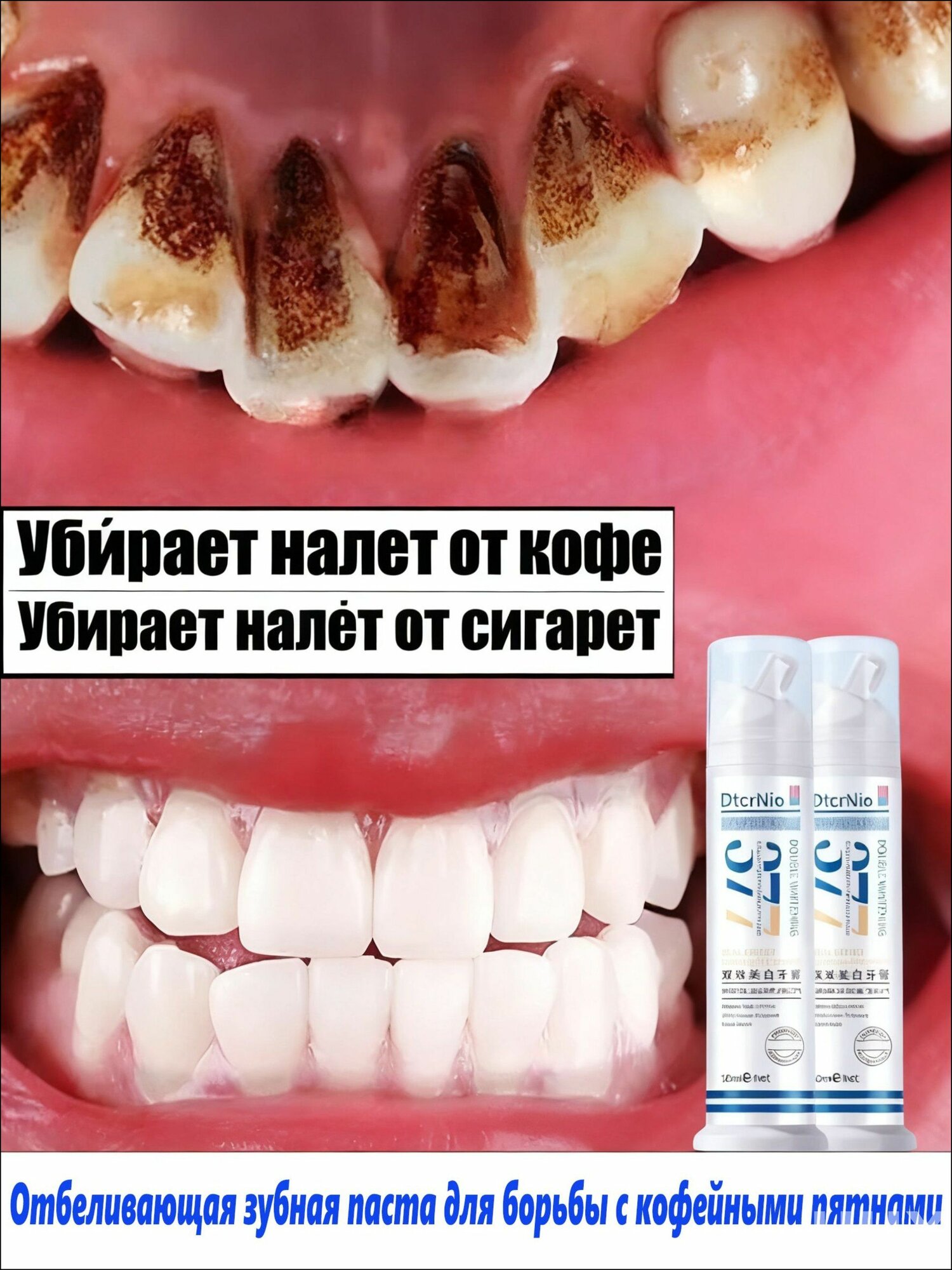 Мощная отбеливающая зубная паста, против зубного камня и налета от кофе и сигарет, против неприятного запаха изо рта, отбеливающая, для чувствительных зубов 120 г