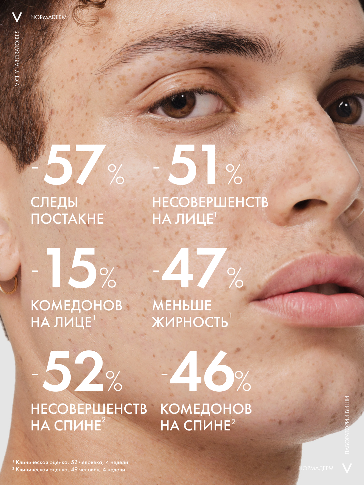 Vichy Normaderm Очищающий гель-сыворотка для умывания лица с эффектом пилинга от прыщей и постакне, с салициловой и гликолевой кислотой, 125 мл — фото 1
