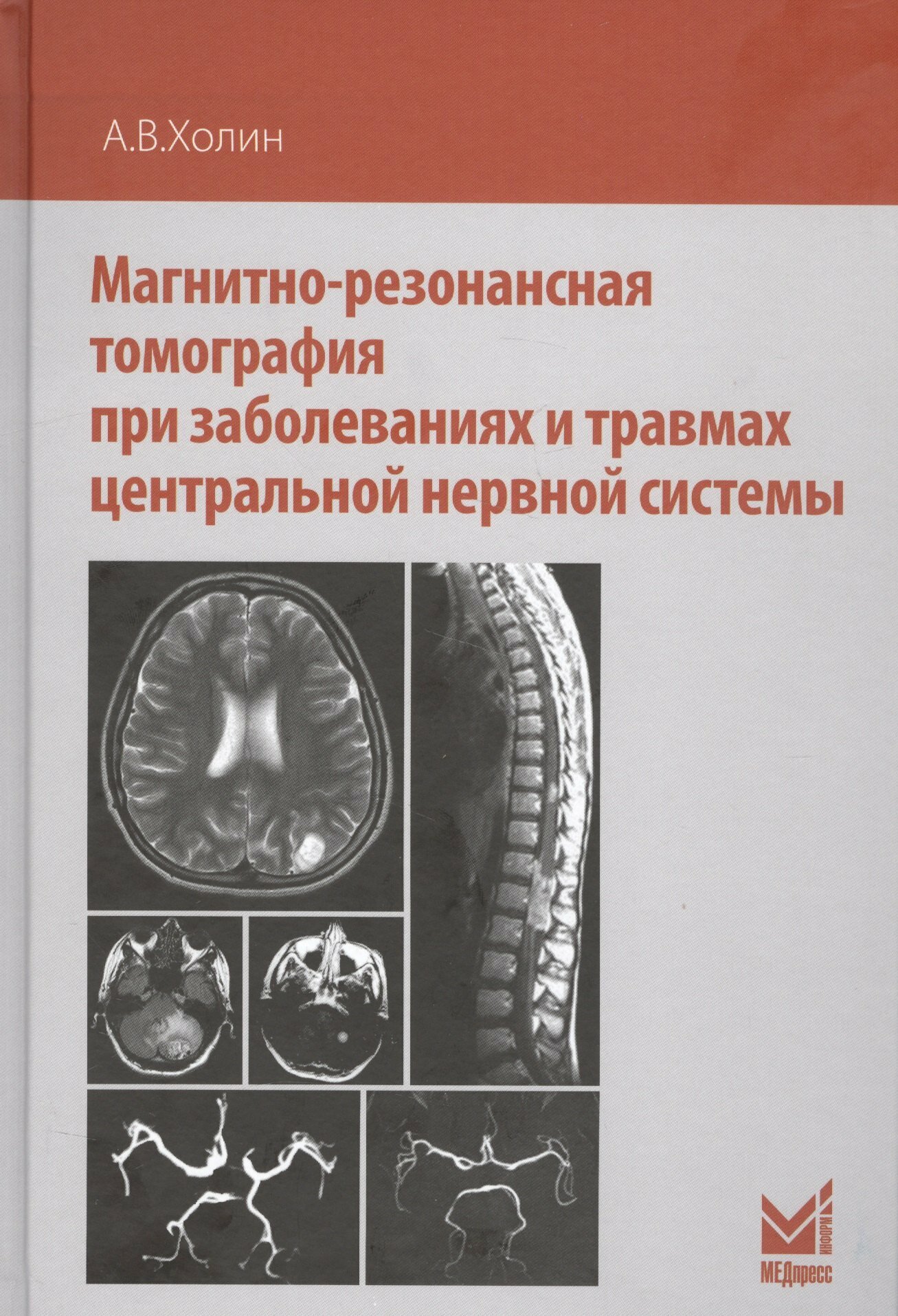 Книга: "Магнитно-резонансная томография при заболеваниях и травмах центральной нервной системы" от Холин А, русский язык, Специализированные отрасли медицины