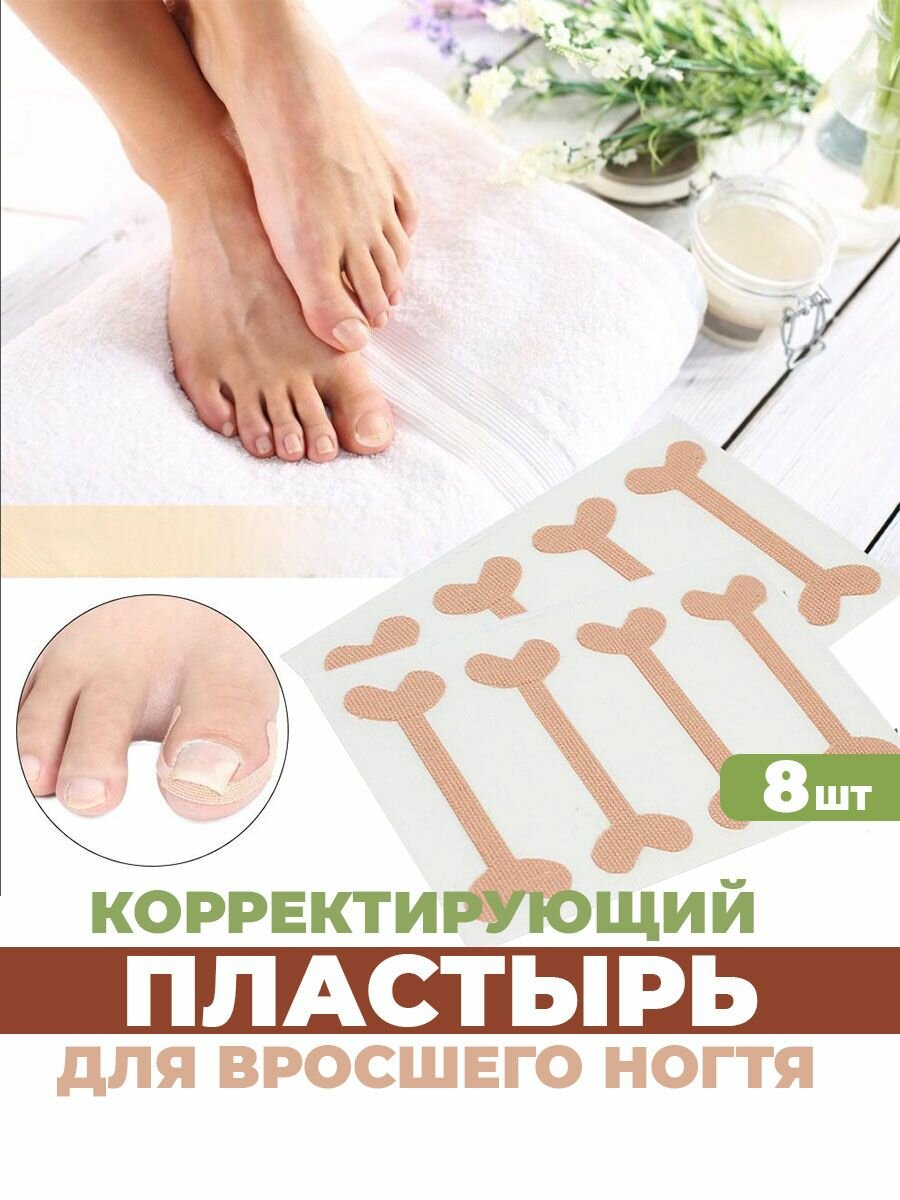 Корректор от вросшего ногтя