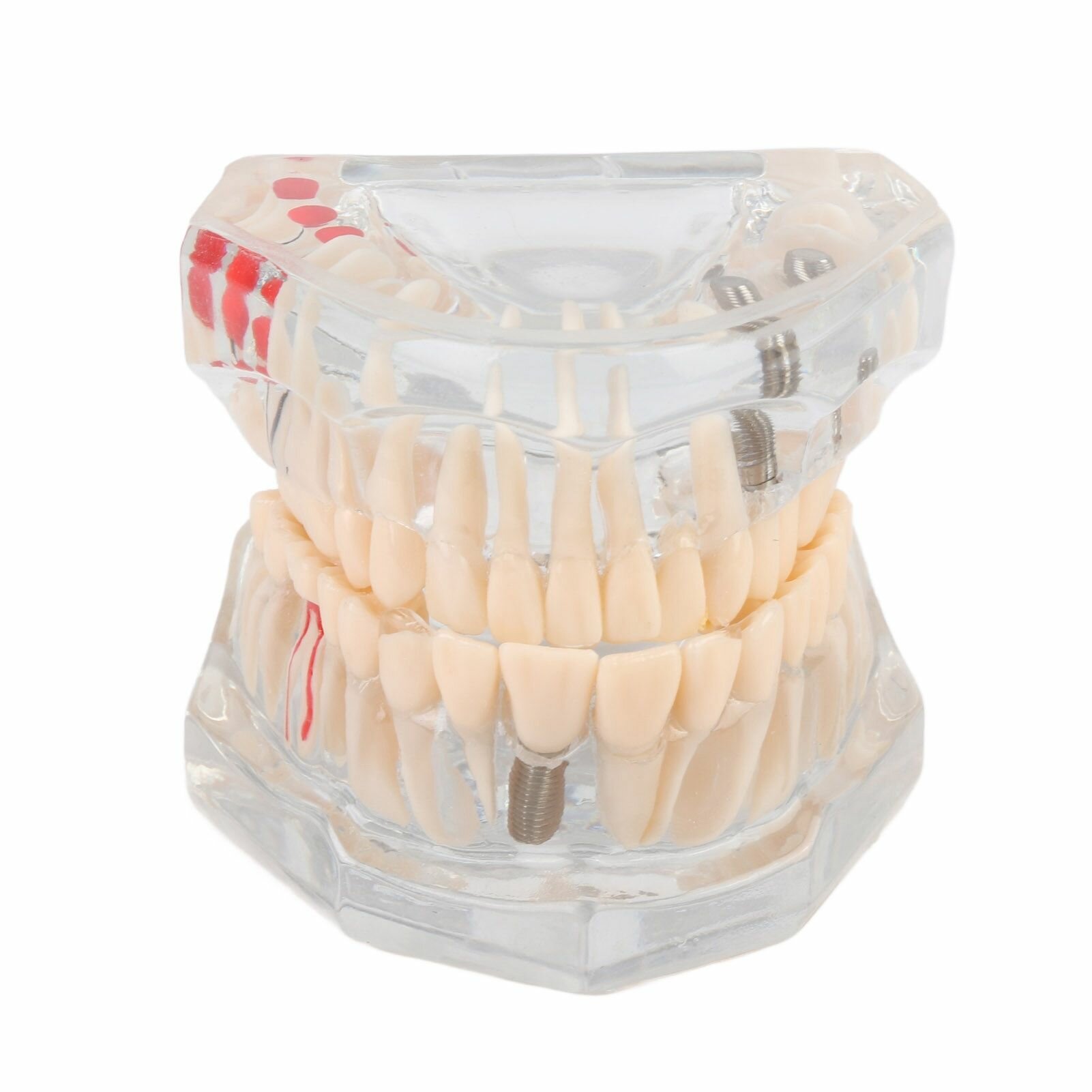 Стоматологическая модель (обучение заболеваниям зубов)