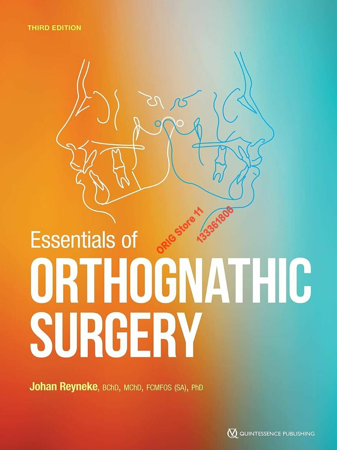 Essentials of Orthognathic Surgery, 3rd Edition Reprinted books