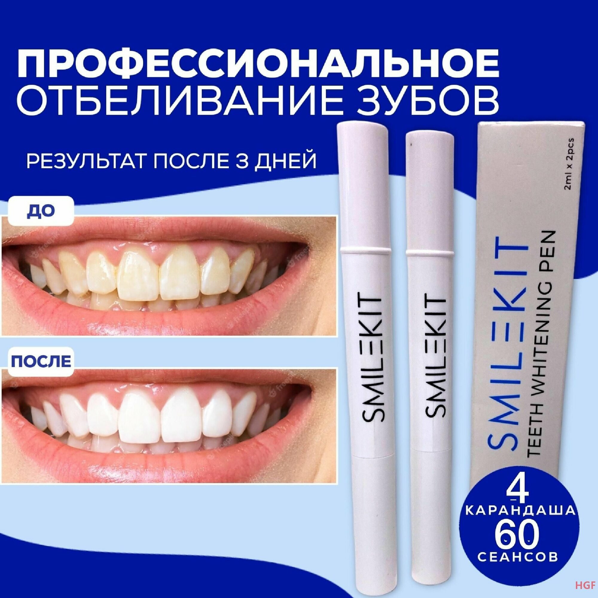 Отбеливающий комплекс