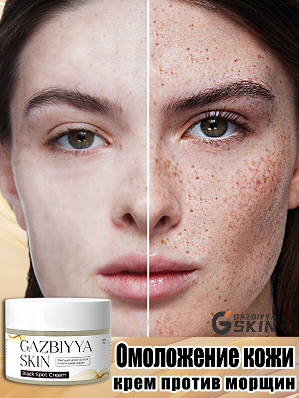 Крем от пигментных пятен и веснушек, отбеливающий, для кожи с пигментацией, 30 г.