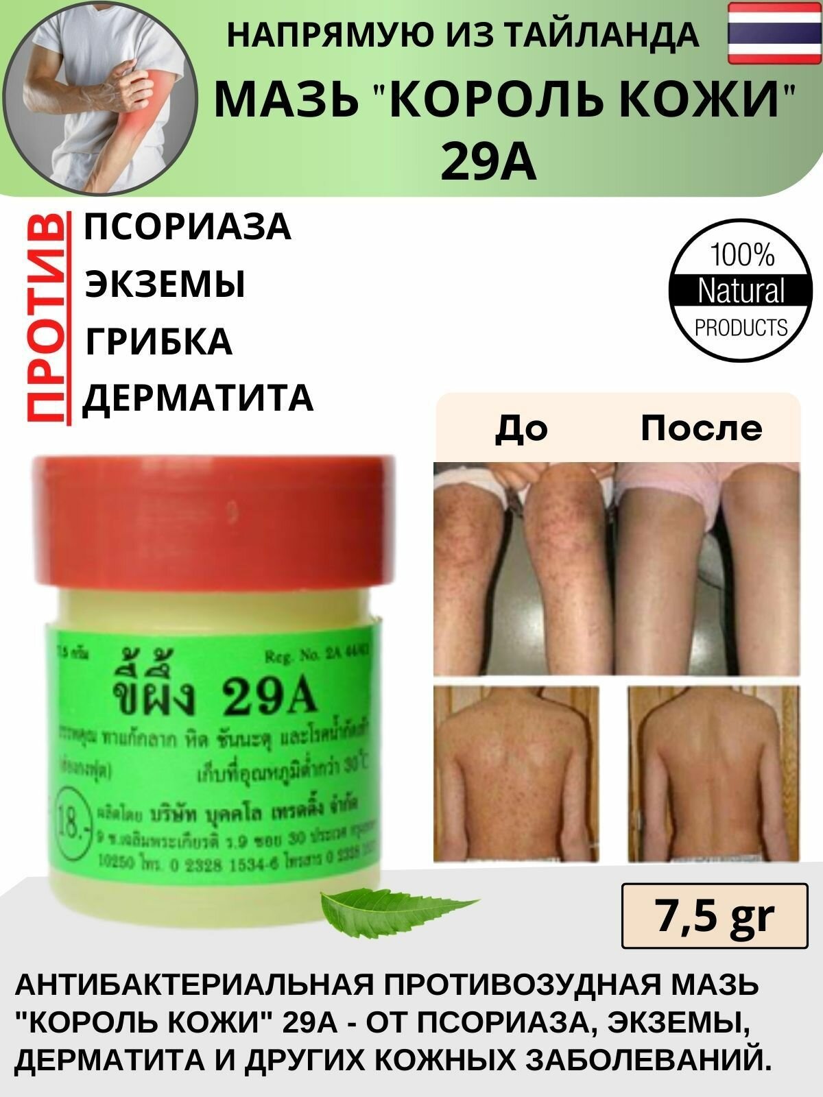 Мазь "Король кожи" от дерматита, псориаза, экземы и других кожных заболеваний, 7 г.