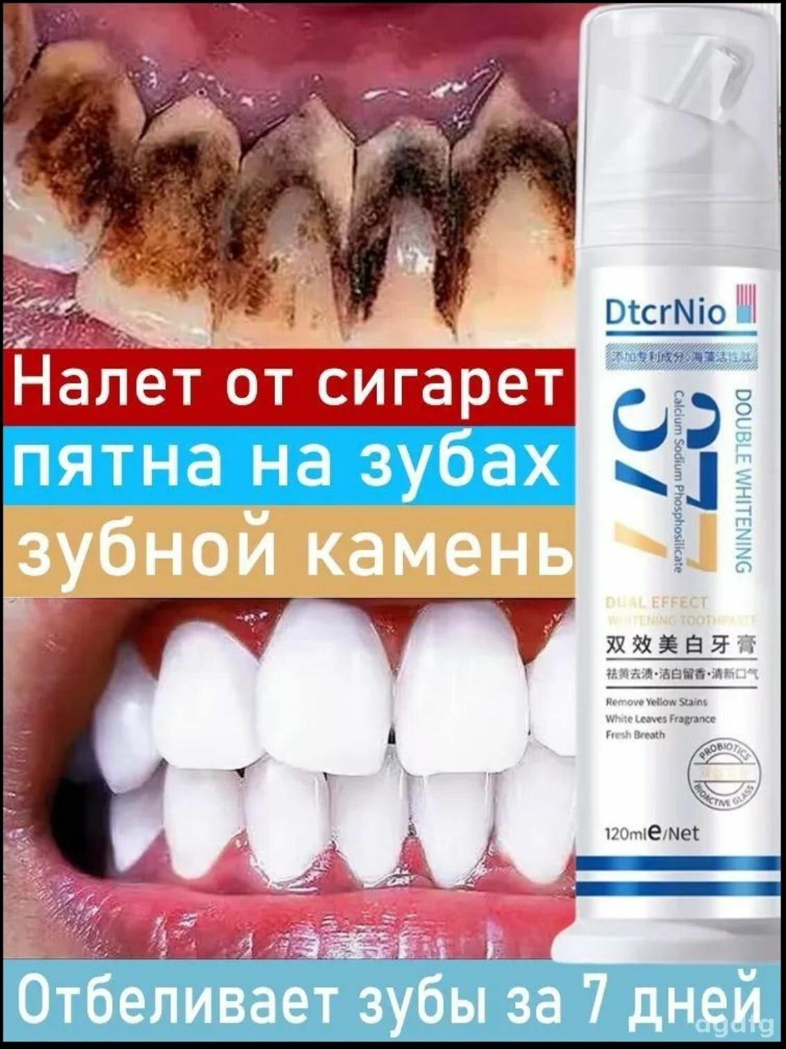 Мощная отбеливающая зубная паста, против зубного камня и налета от кофе и сигарет, против неприятного запаха изо рта, отбеливающая, для чувствительных зубов 120 г