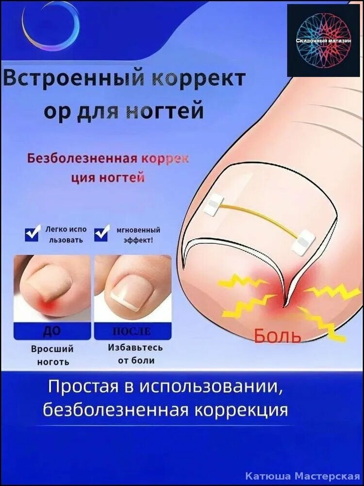 Эксклюзивный набор 10 корректоров от вросших ногтей из никелидтитана LC