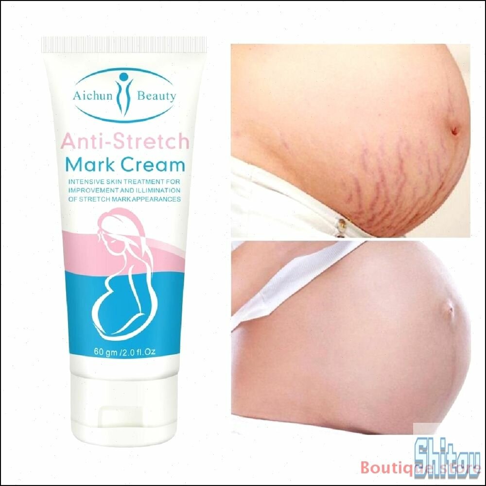 Средство от растяжек