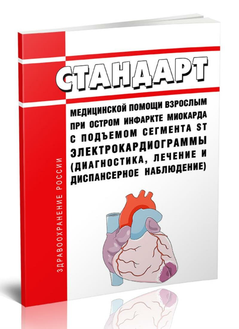 Стандарт медицинской помощи взрослым при остром инфаркте миокарда с подъемом сегмента ST электрокардиограммы (диагностика, л