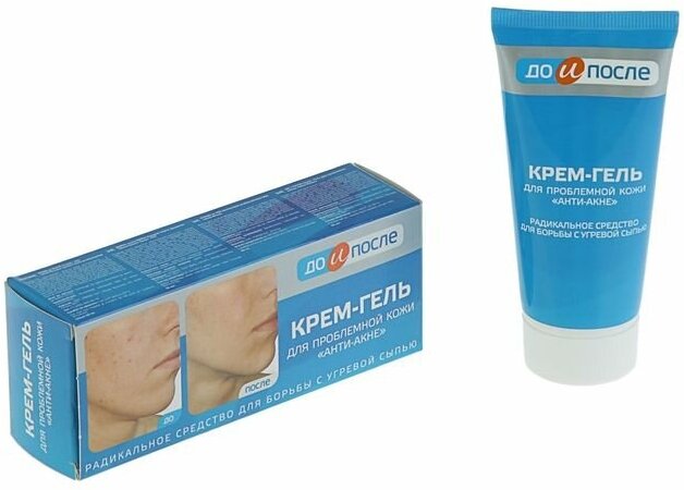 Крем-гель "До и После" Анти-Акне для проблемной кожи, 50 мл