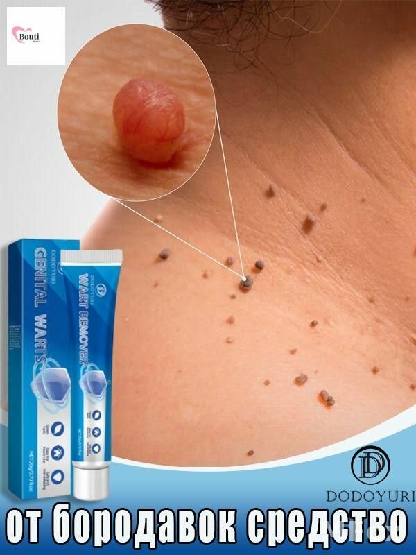Крем косметиЧеский локального применениЯ от паппилом и бородавок/Средство от папиллом и бородавок DODOYURI гель /20г