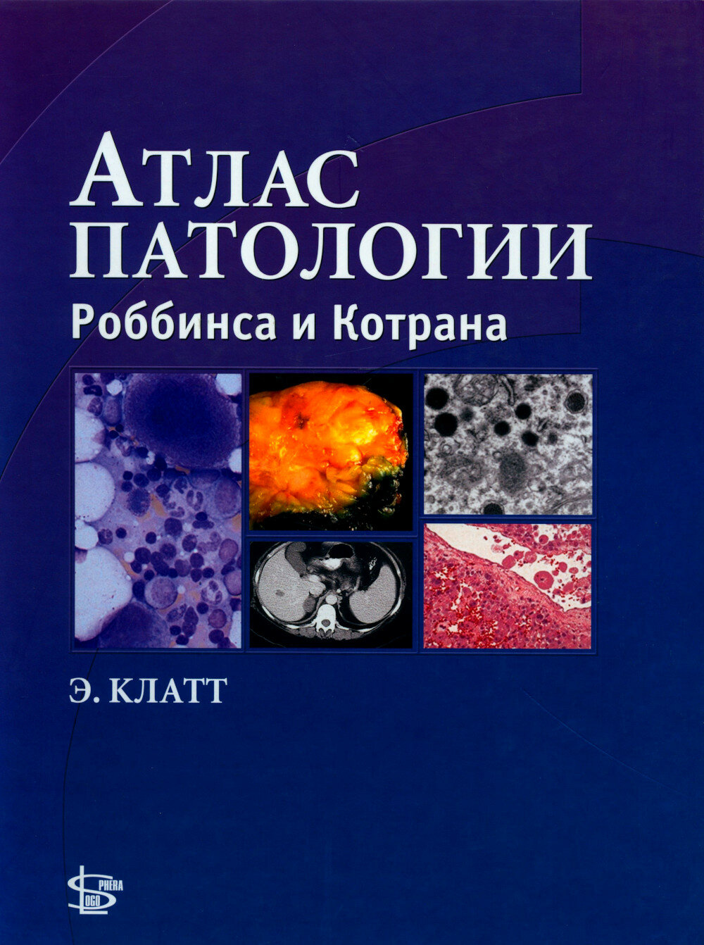 Уценка Атлас патологии Роббинса и Котрана. Клатт Э.К.