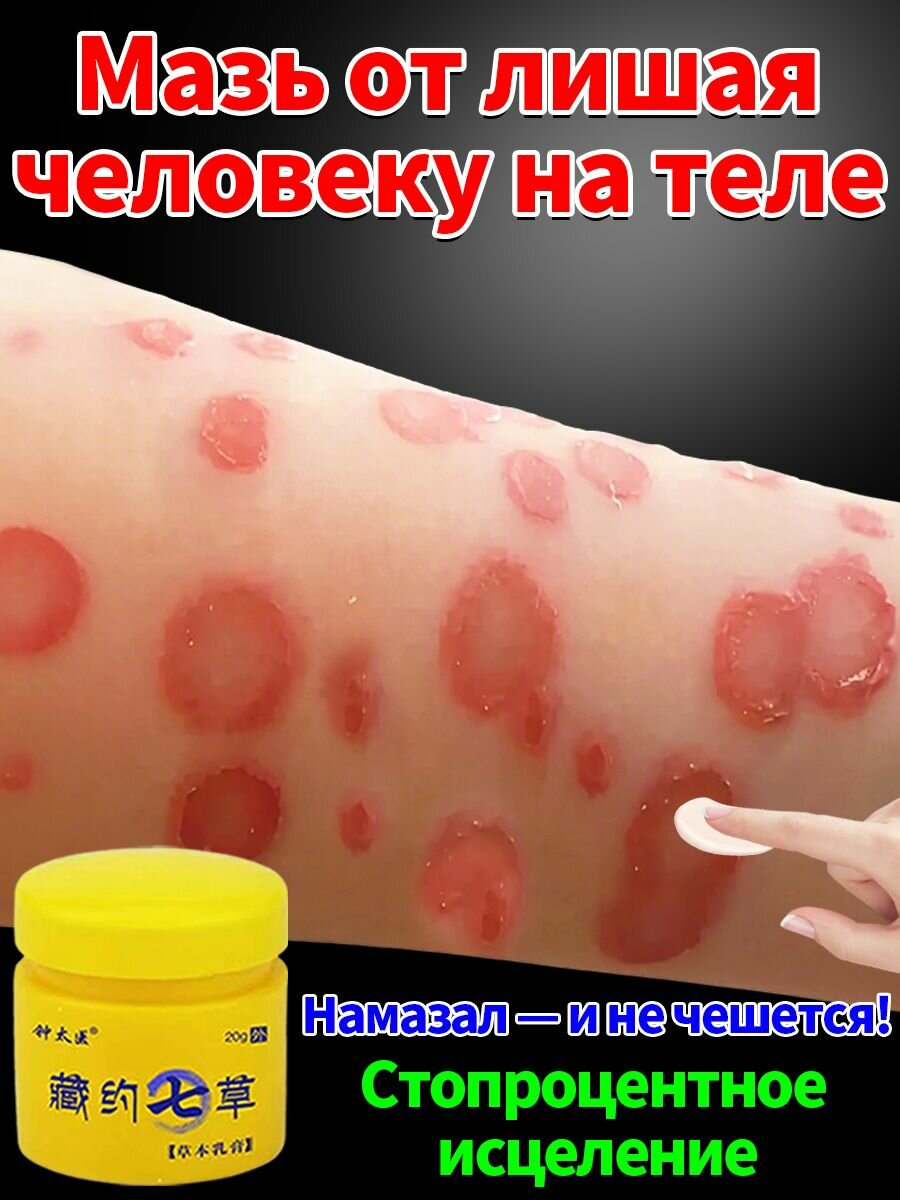 Мазь от лишая на теле у человека