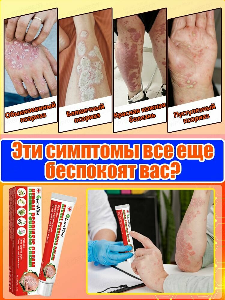 Комплексный крем 60 мл: от псориаза, акне (постакне), экземы, дерматита (атопического, контактного), грибка