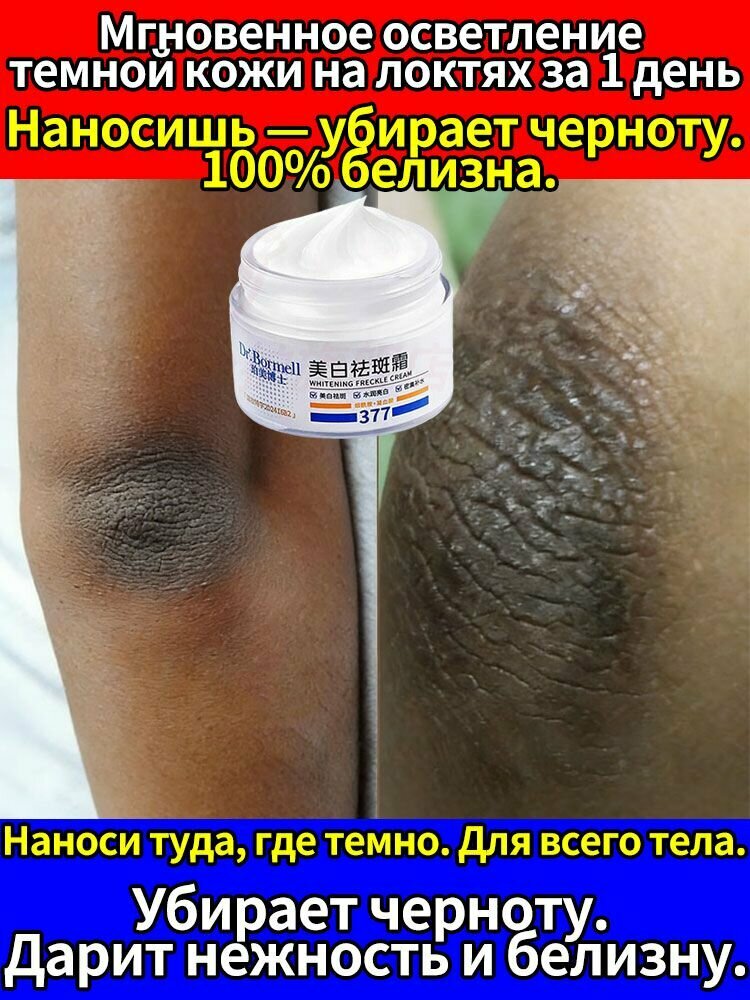 Отбеливающий крем для тела, интимной зоны, подмышек и локтей