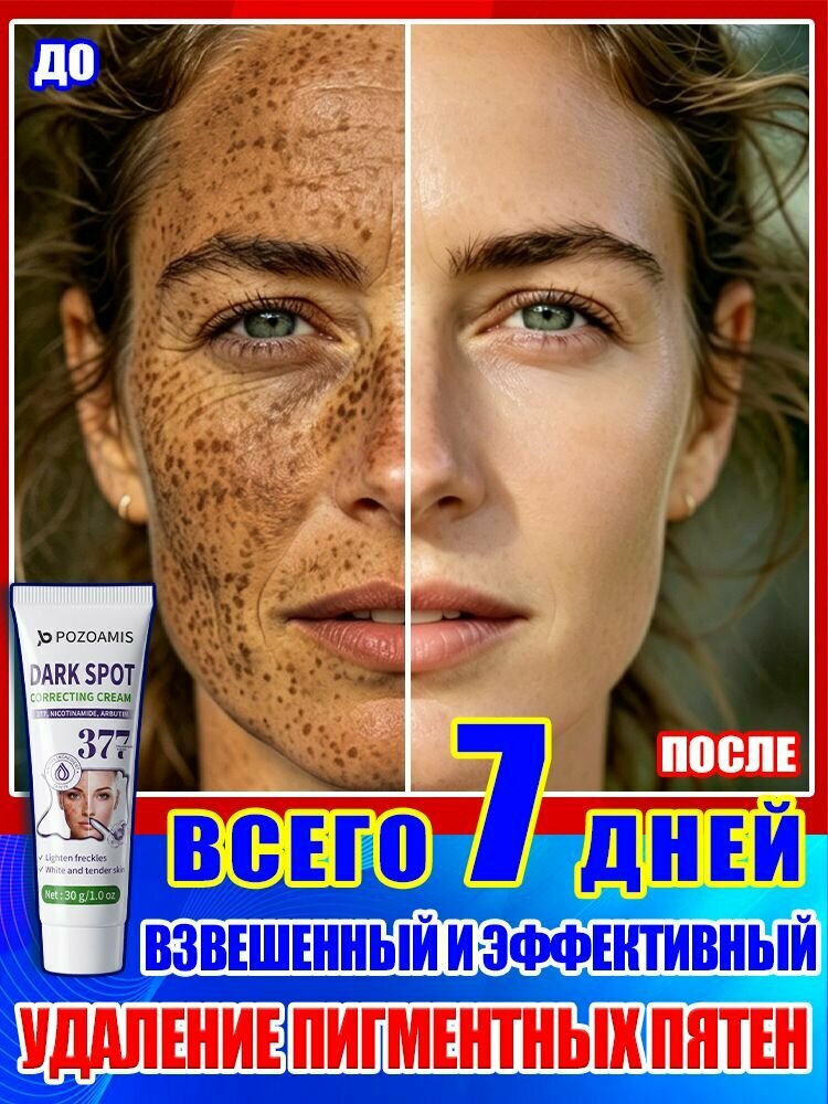 Крем от пигментных пятен с ниацинамидом и -арбутином осветляет тон, убирает пигментацию, увлажняет и восстанавливает кожу. 150 мл