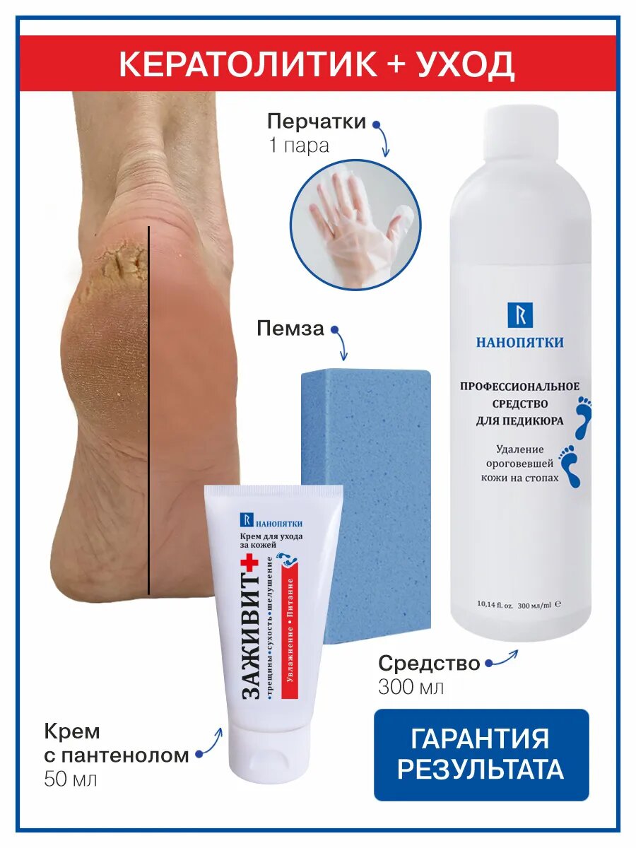 От трещин на пятках. Набор № 26