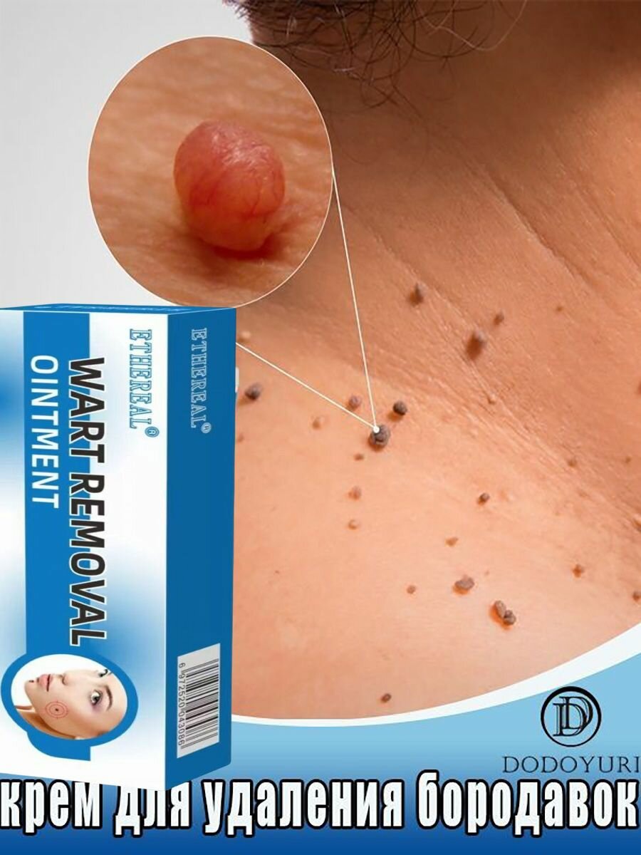 Эффективно лечит родинки, папилломы и разные виды бородавок / Средство от папиллом и бородавок DODOYURI гель ./ 60г