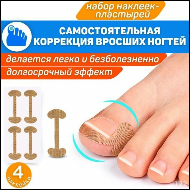 Корректор от вросшего ногтя
