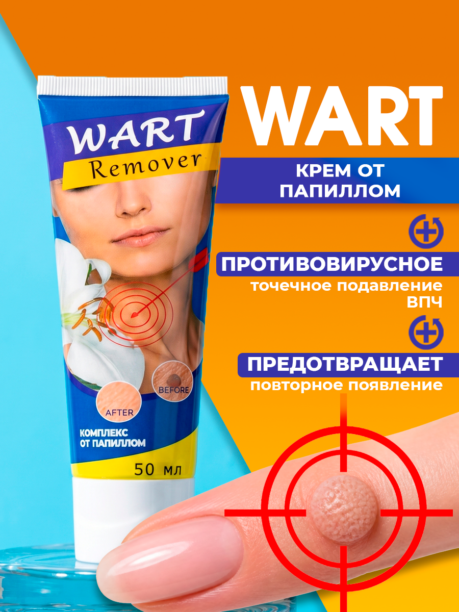 Крем-гель от папиллом, WART Remover от бородавок и сухих мозолей, 50 мл/Варт Ремовер