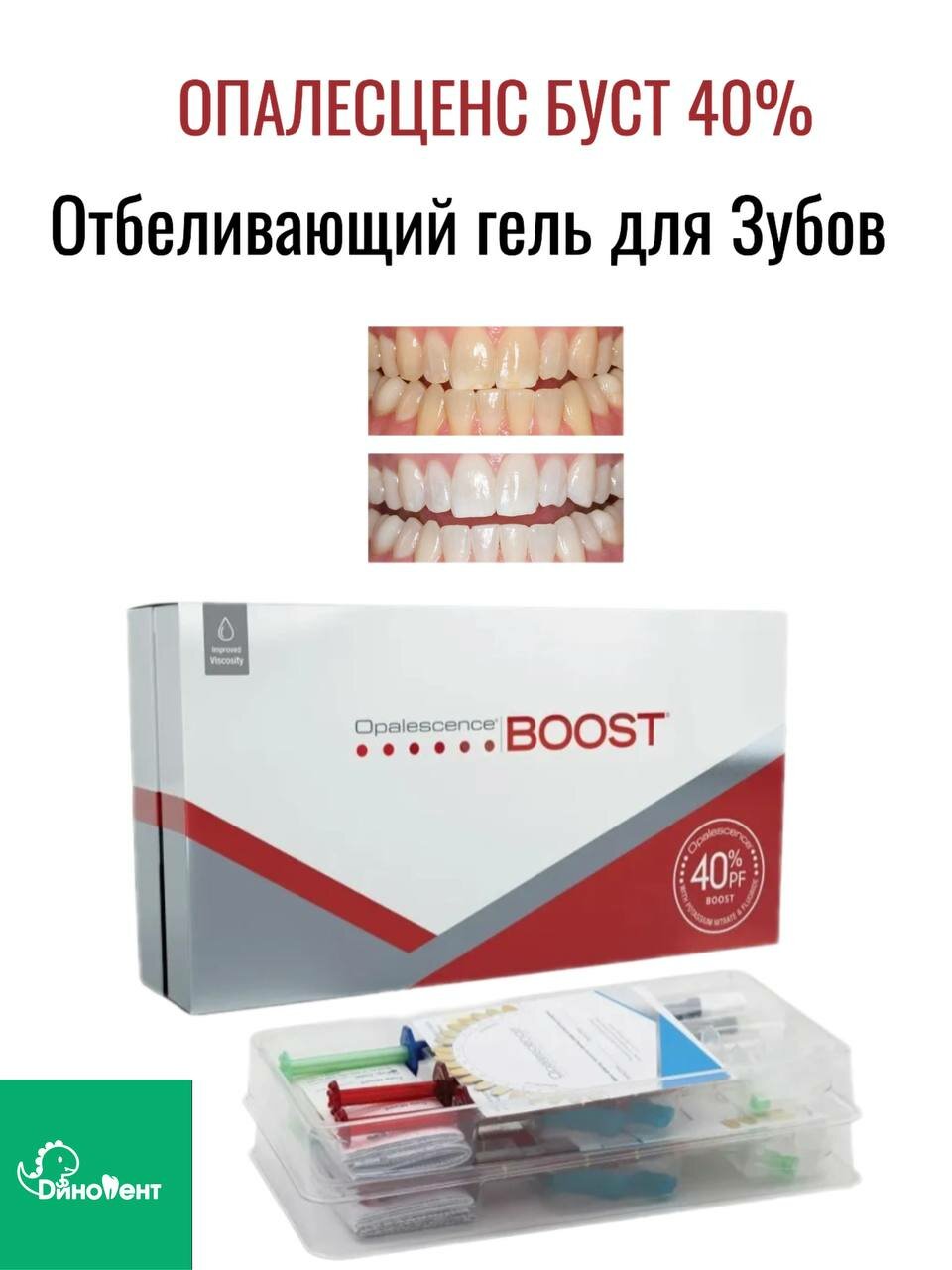 Набор для отбеливания зубов Opalescence Boost 40%, гель для осветления эмали и ухода за улыбкой