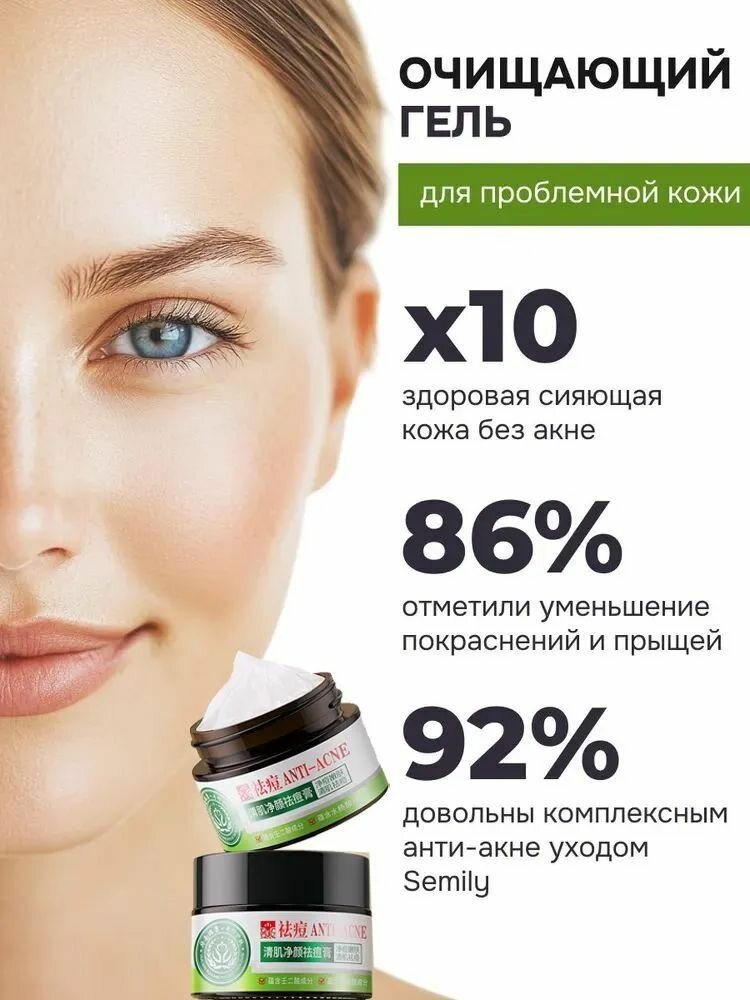 Крем для лица от прыщей от черных точек и угрей, жирной и чувствительной кожи, Снять воспаление на лице для подростков и взрослых 30г