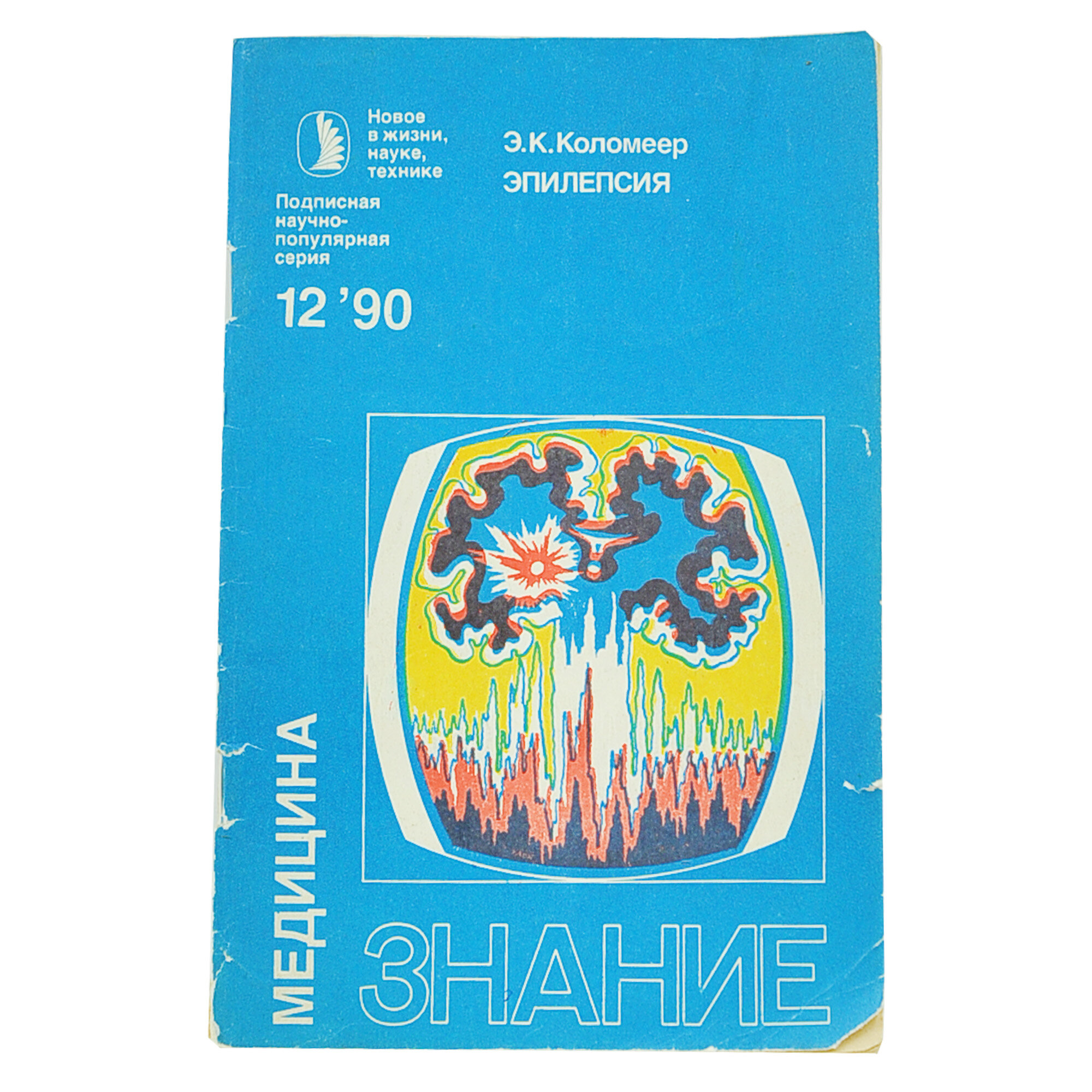 Эпилепсия
