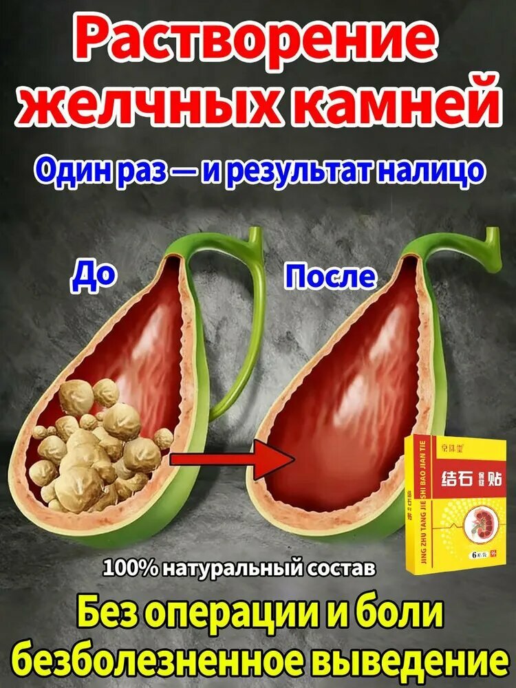 Пластырь от камней в почках удаляет камни в желчном пузыре, предотвращает образование камней и быстро облегчает боль 6 пластырей
