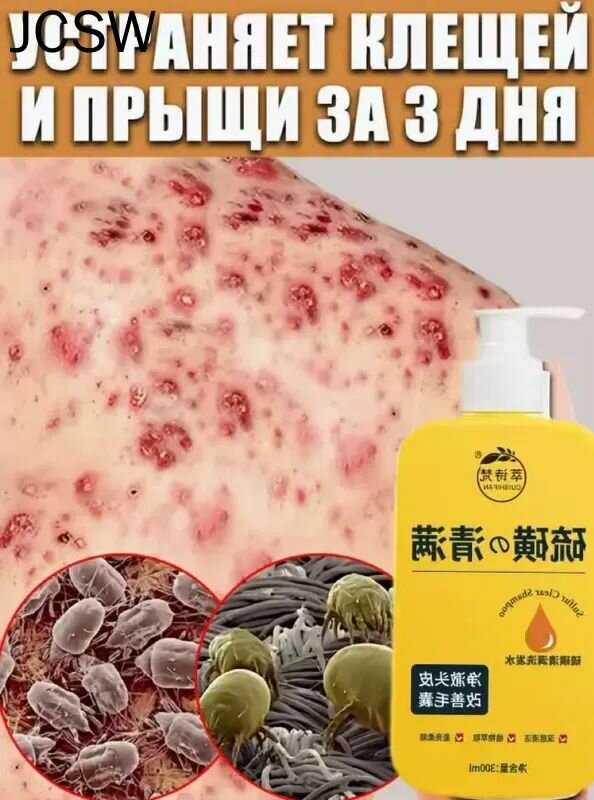 Гель для душа с серой против клещей Зудящая кожа, удаляет прыщи, красные пятна, прыщи и клещей на спине 300 мл