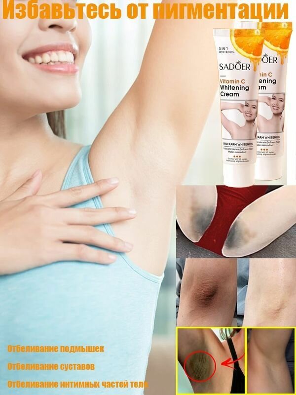 Крем для отбеливания подмышек, средство против пигментации и витамин С, отбеливающий суставы и интимные части тела